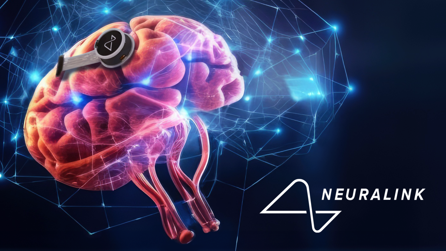 Neuralink patient 2 plays Counter-Strike with his brain implant ...